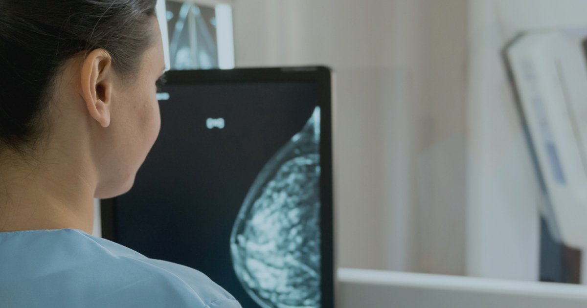 Solis Mammography tapped by American College of Radiology for research ...